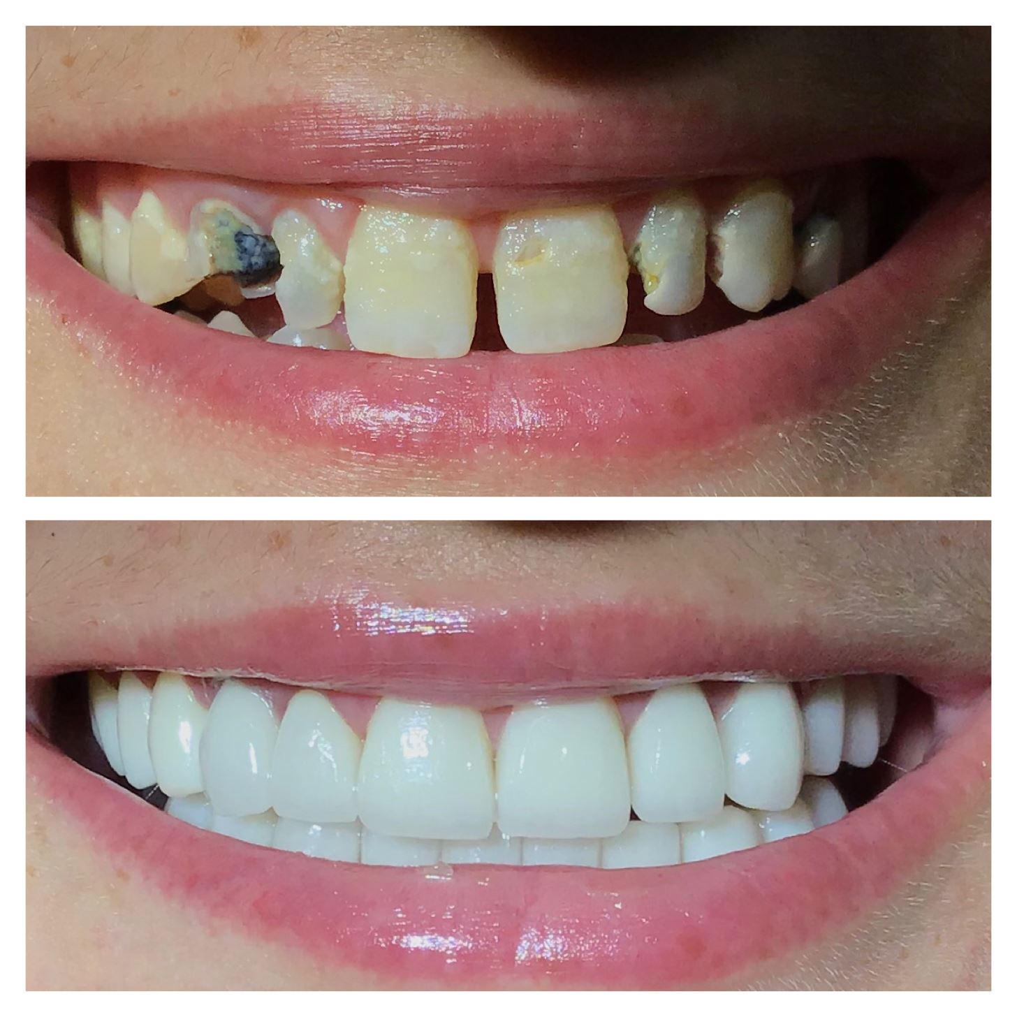Treatment and Smile Gallery | Pelican Dental Care