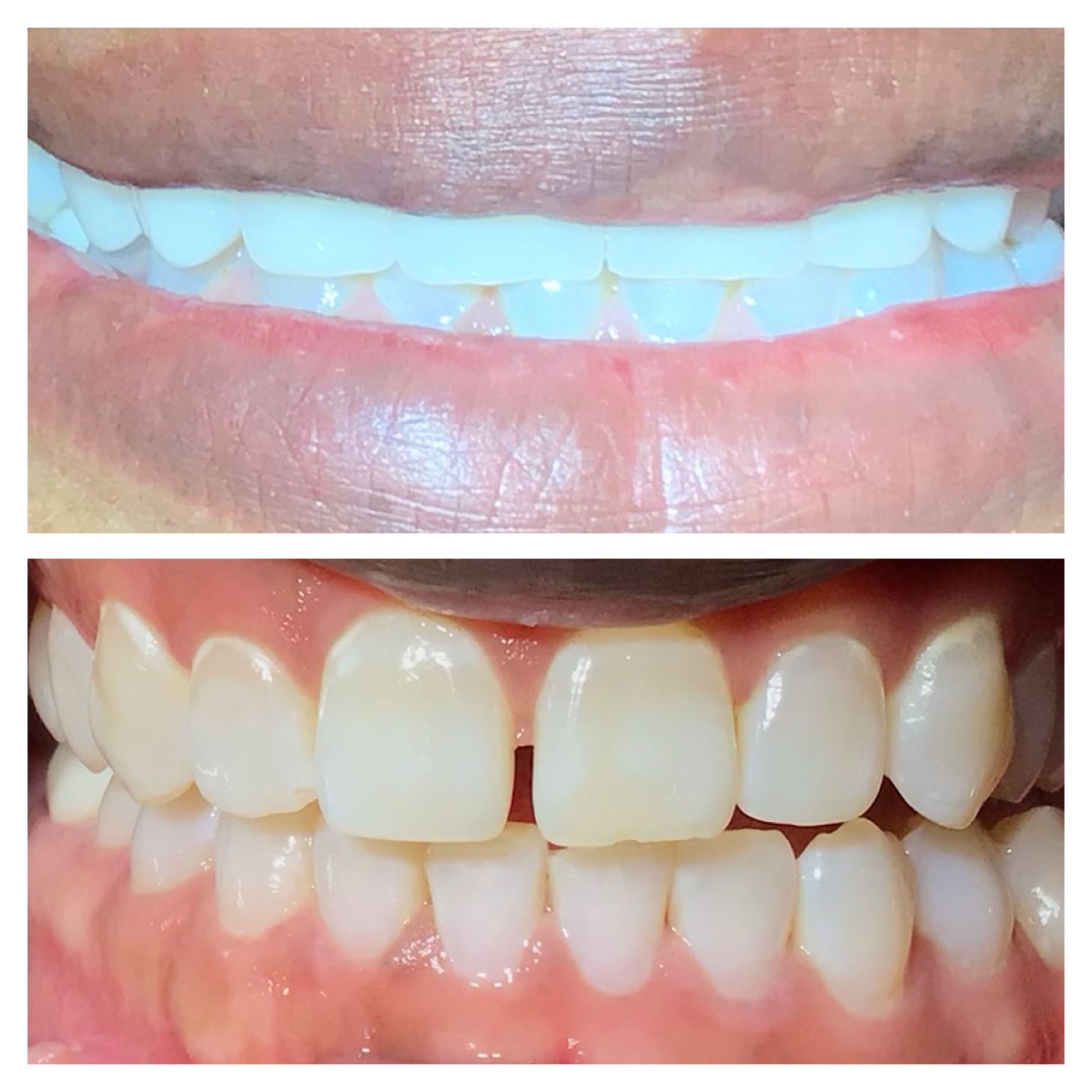 Treatment and Smile Gallery | Pelican Dental Care